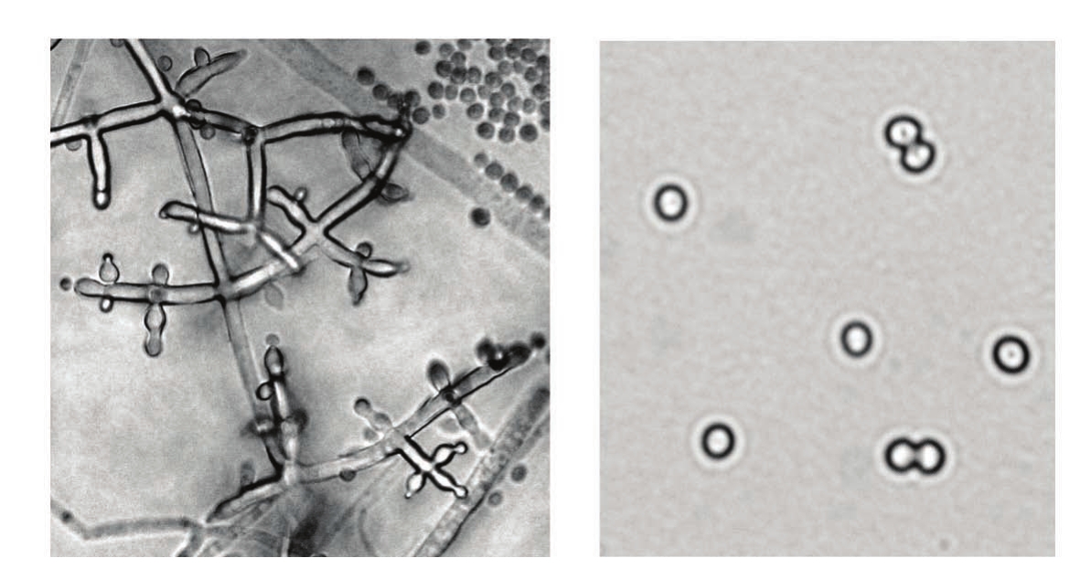 一、玉米真菌病害（Maize Diseases Caused by Fungus）_植保专题库