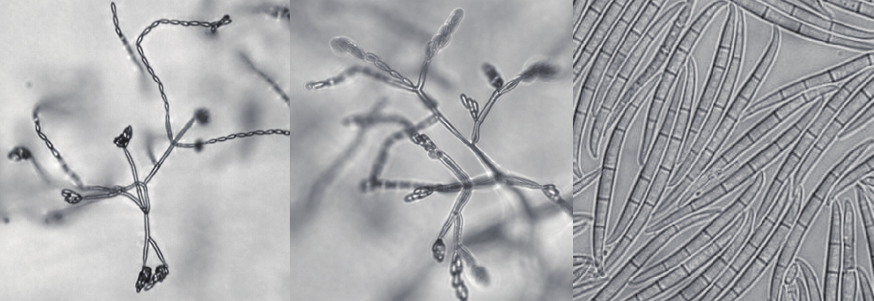 一、高粱真菌病害（Diseases Caused by Fungi）_植保专题库