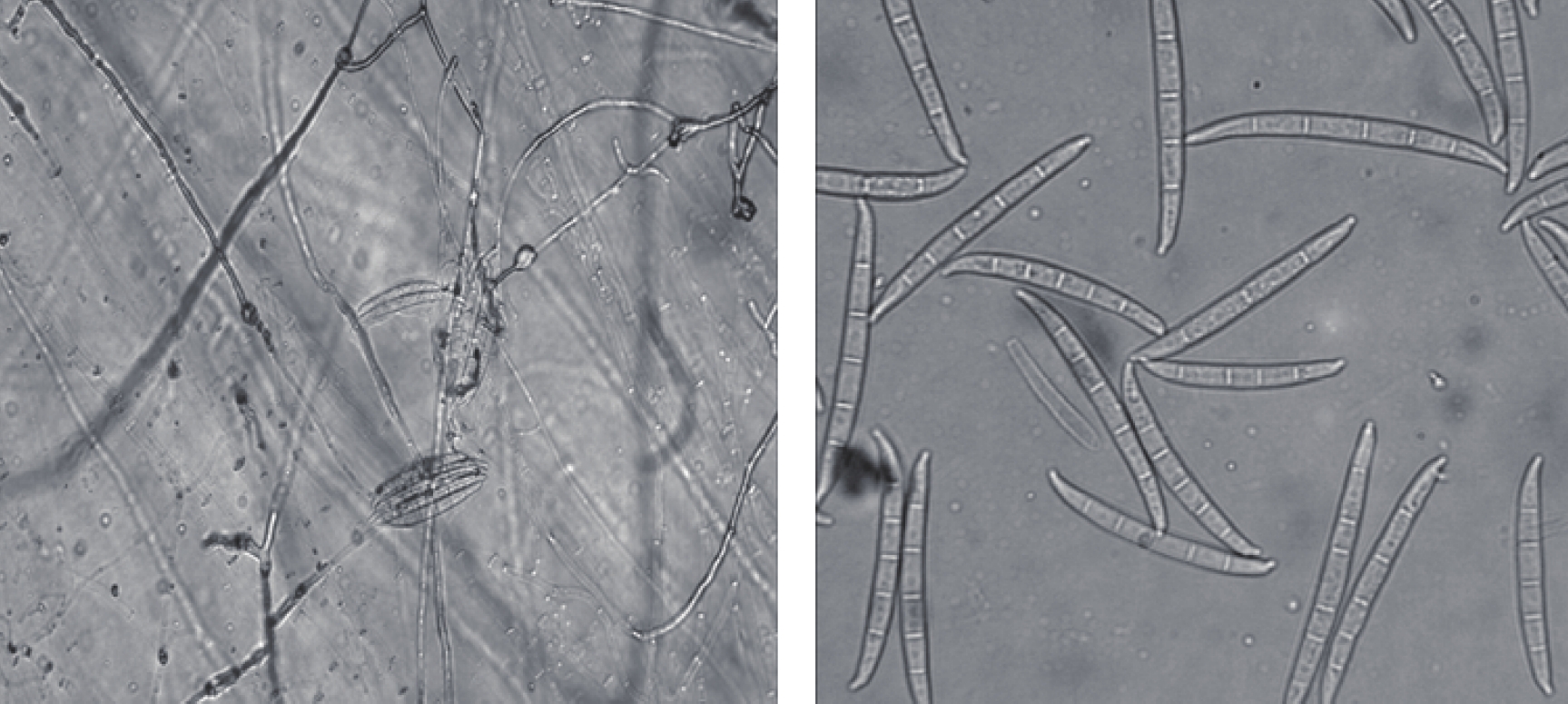 一、高粱真菌病害（Diseases Caused by Fungi）_植保专题库