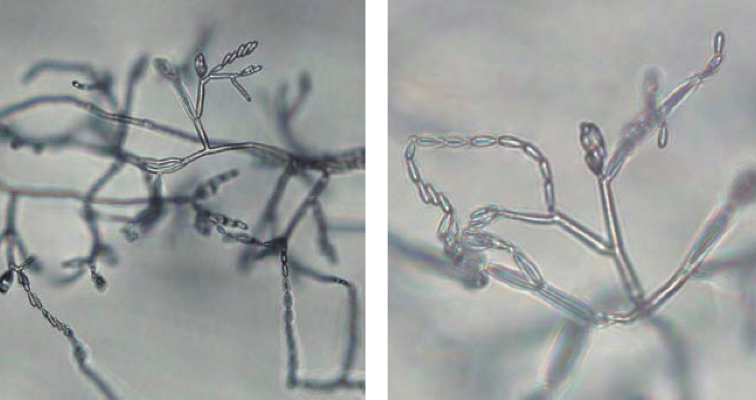 一、高粱真菌病害（Diseases Caused by Fungi）_植保专题库