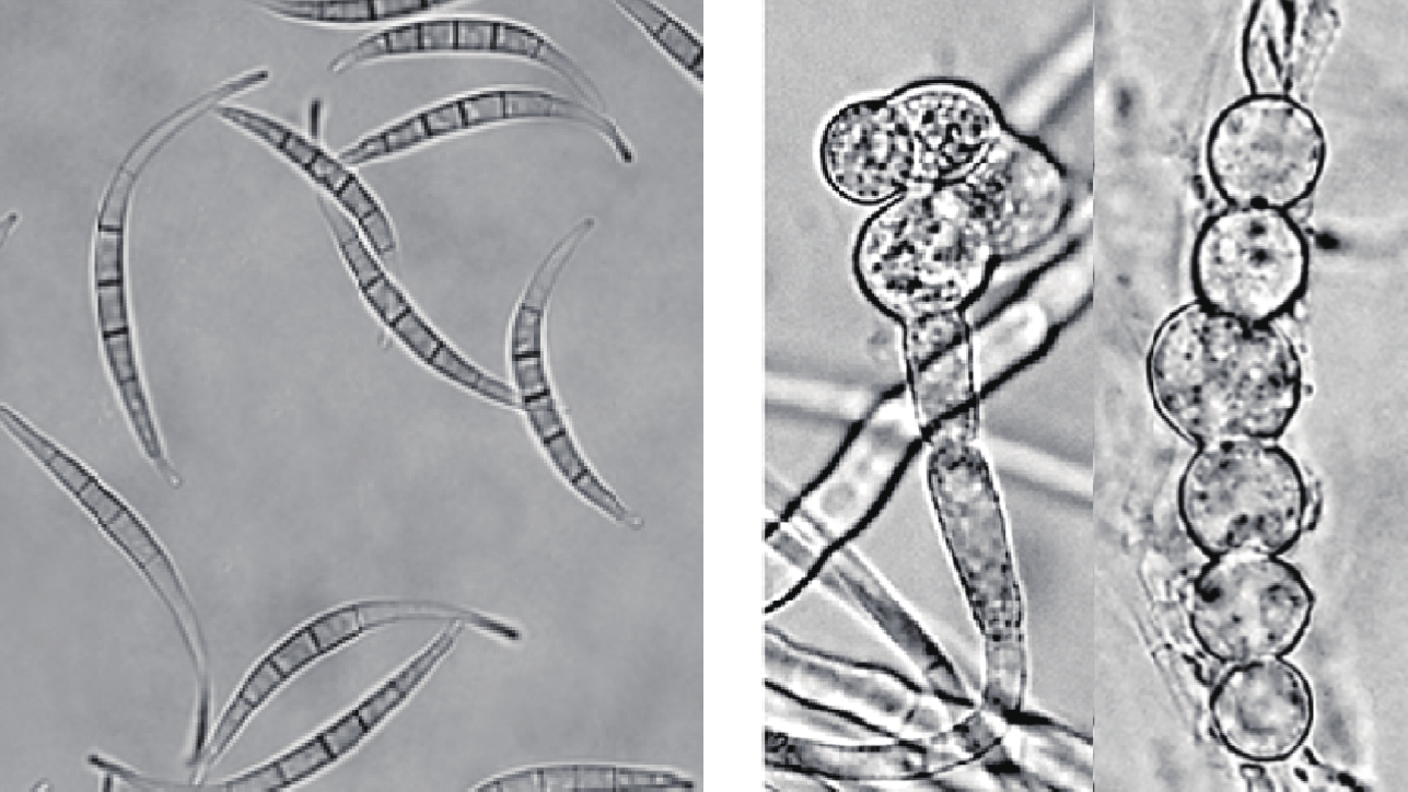 一、高粱真菌病害（Diseases Caused by Fungi）_植保专题库