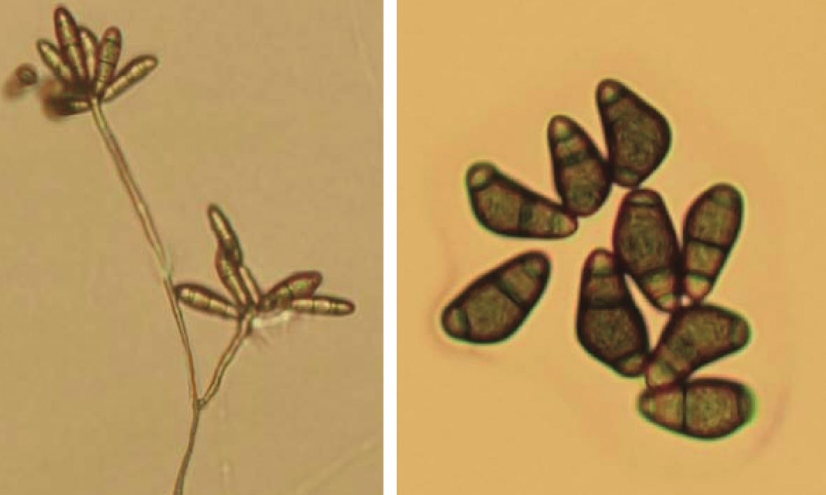 一、高粱真菌病害（Diseases Caused by Fungi）_植保专题库