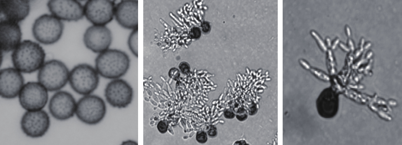 一、高粱真菌病害（Diseases Caused by Fungi）_植保专题库